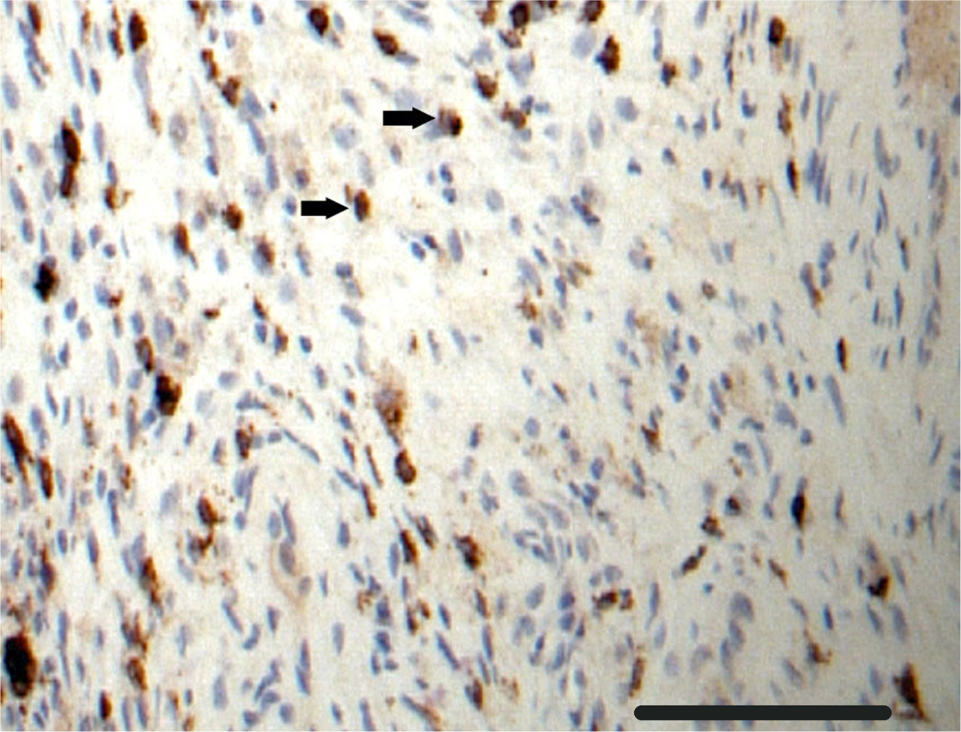 Cluster of differentiation 8 T-cell population in the laryngeal mucosa ...