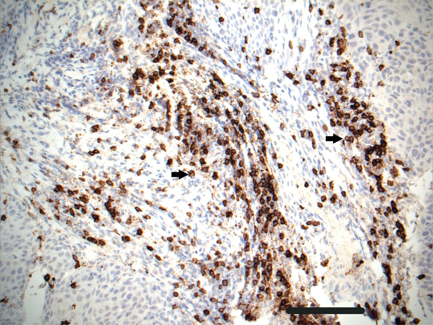 Cluster of differentiation 8 T-cell population in the laryngeal mucosa ...
