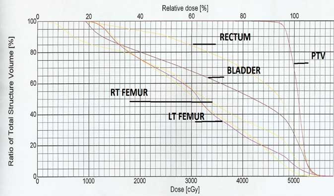 Evaluation of various dose homogeneity indices for treatment of ...