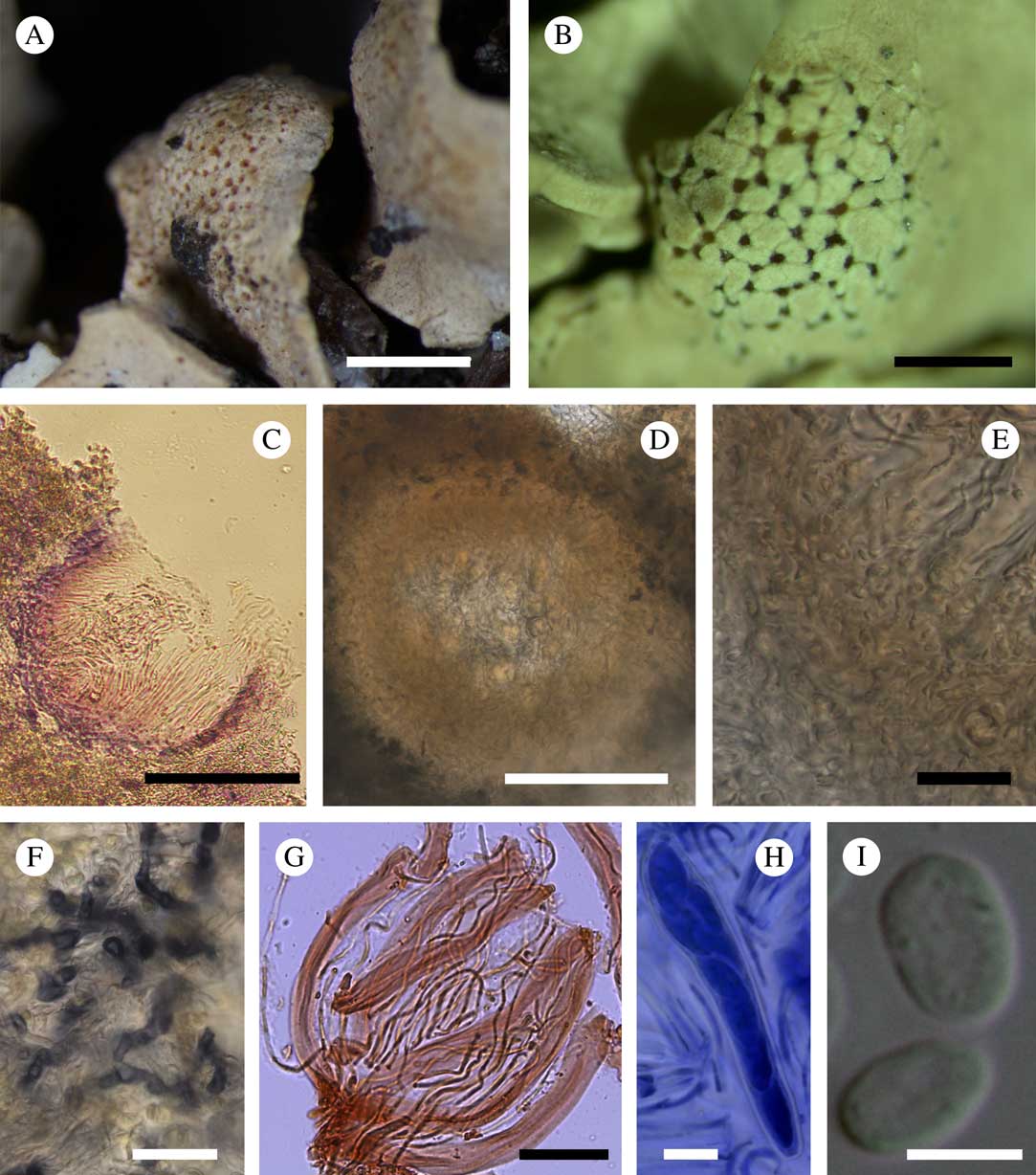 Lichenicolous ascomycetes on Siphula-like lichens, with a key to the ...