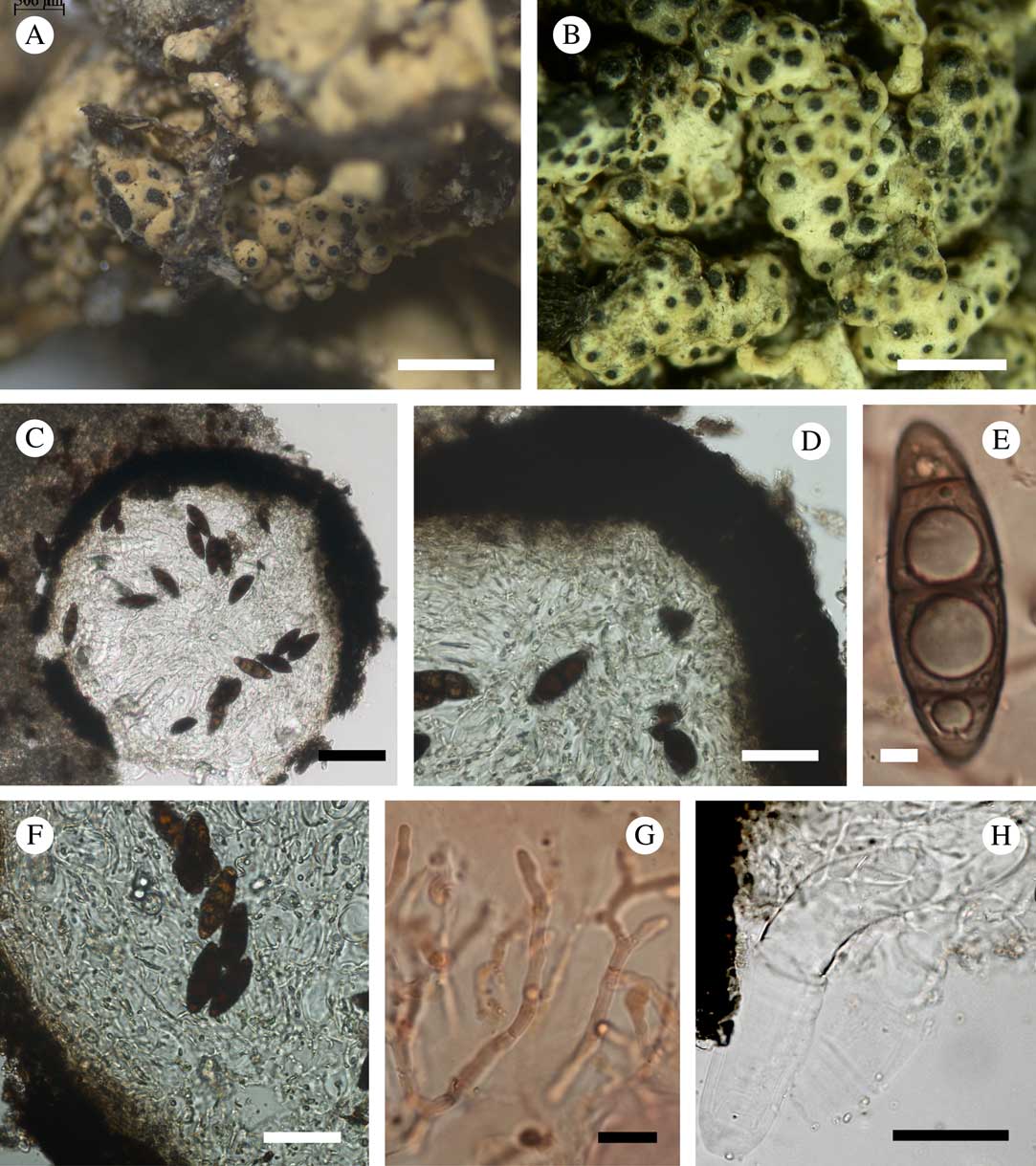 Lichenicolous ascomycetes on Siphula-like lichens, with a key to the ...