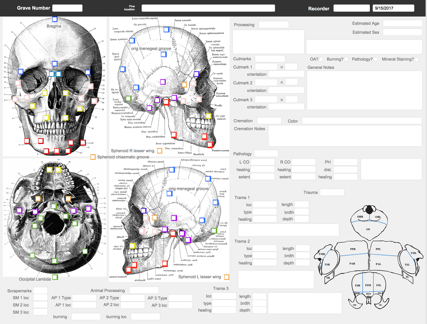 Advances in Documentation of Commingled and Fragmentary Remains ...