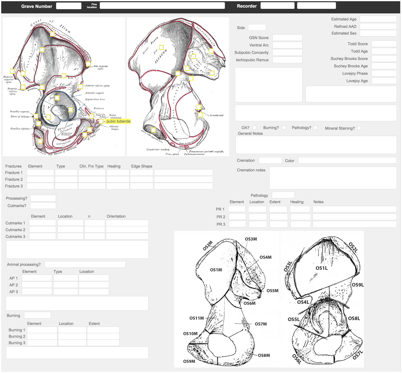 Advances in Documentation of Commingled and Fragmentary Remains ...