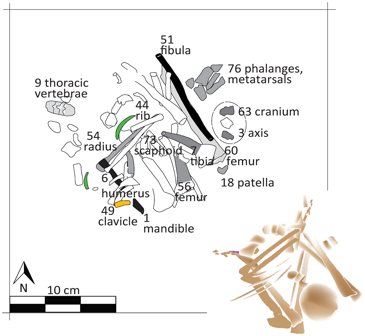 Excavation and Curation Strategies for Complex Burials in Tropical ...