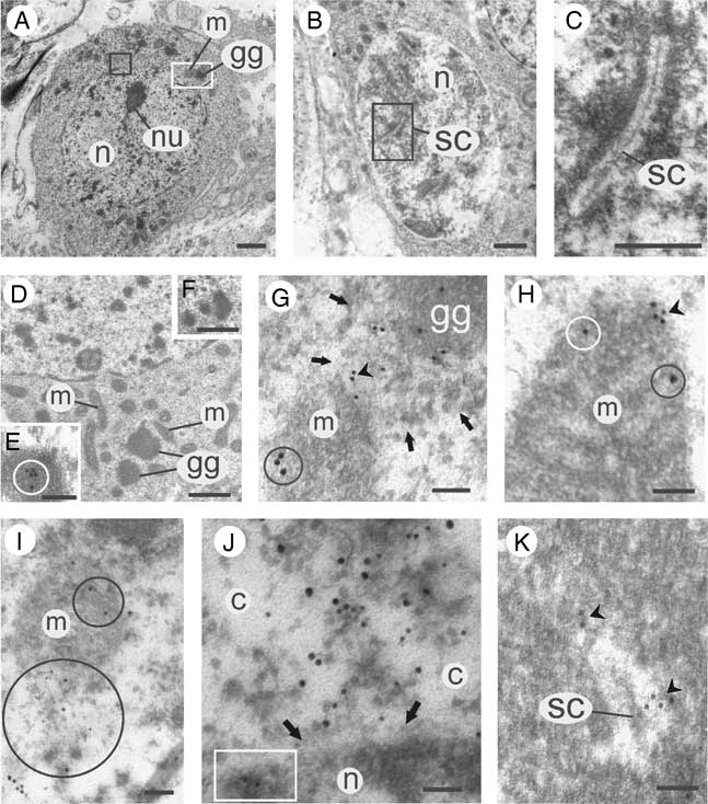 Germ plasm provides clues on meiosis: the concerted action of germ ...
