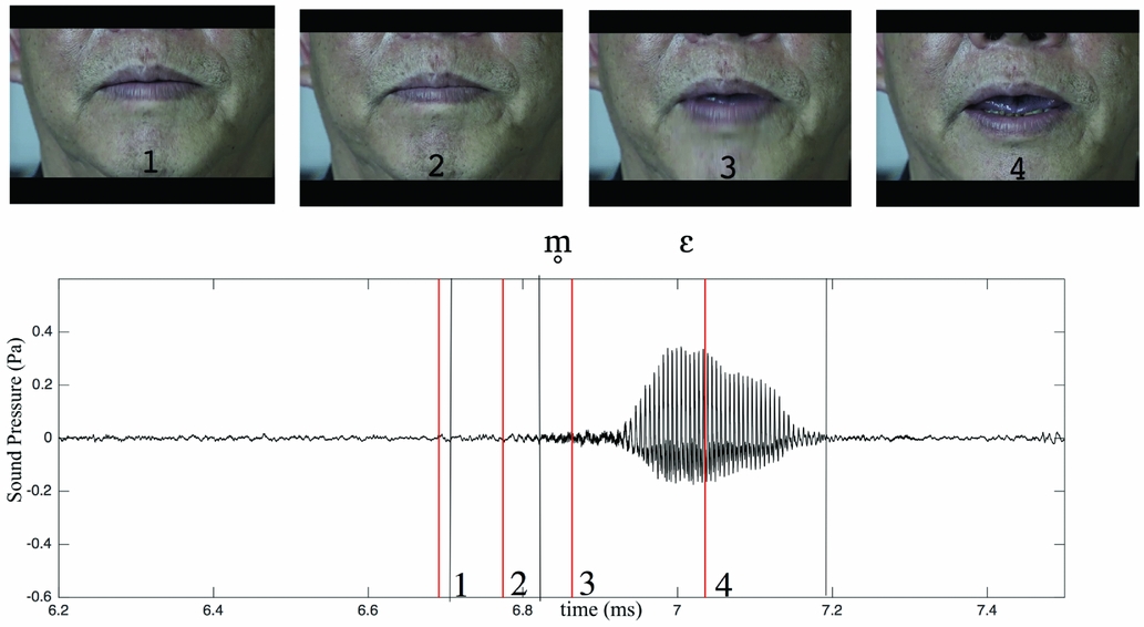 Voiceless nasal sounds in three Tibeto-Burman languages | Journal of ...