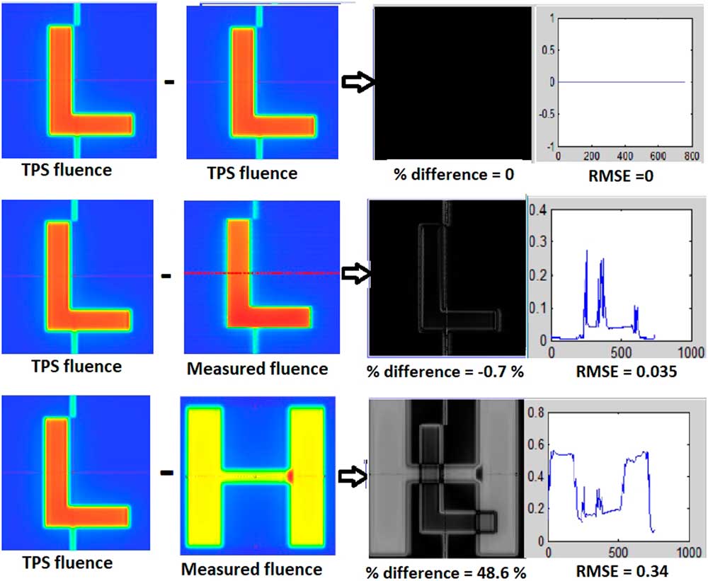 Quality assurance of linear accelerator: a comprehensive system using electronic portal imaging ...