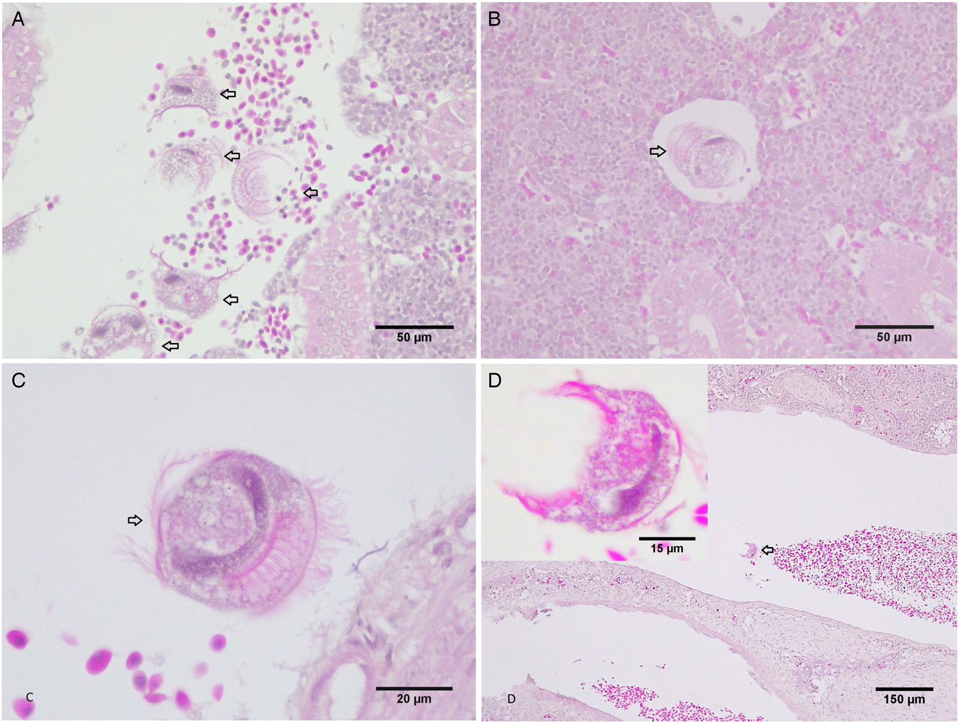 Trichodinid infections in internal organs of shorthorn sculpin ...