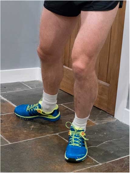 Occupational therapy for functional neurological disorders: a scoping ...