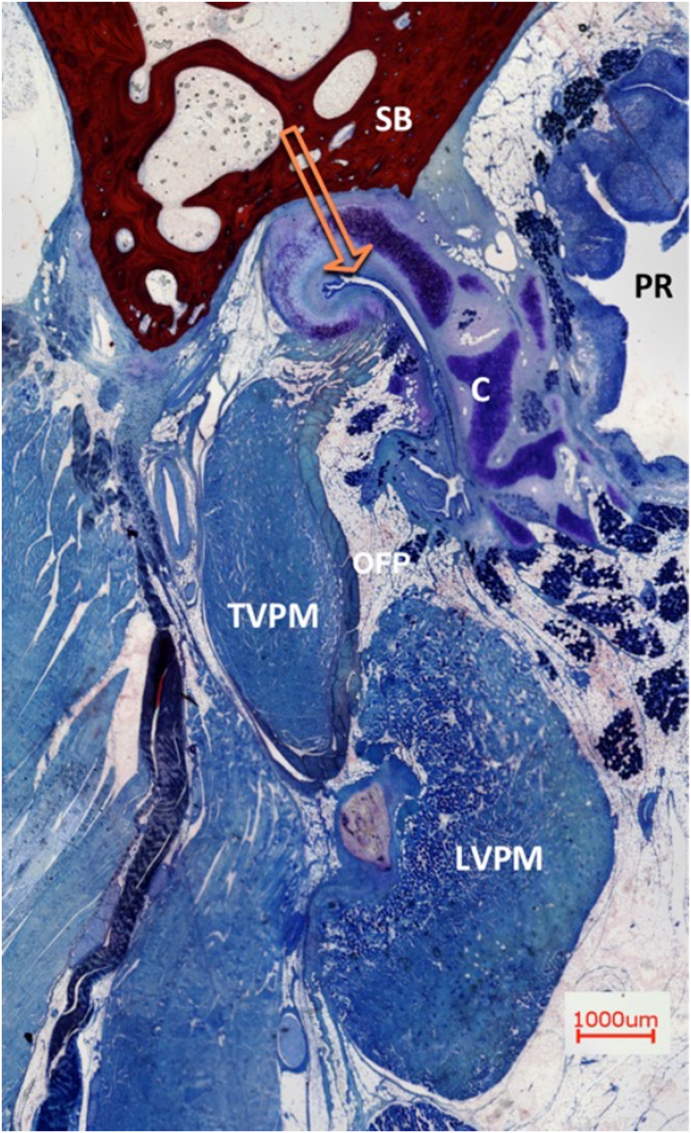 Intraluminal three-dimensional optical coherence tomography – a tool ...