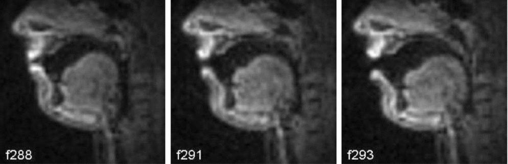 Is vowel nasalisation phonological in English? A systematic review ...
