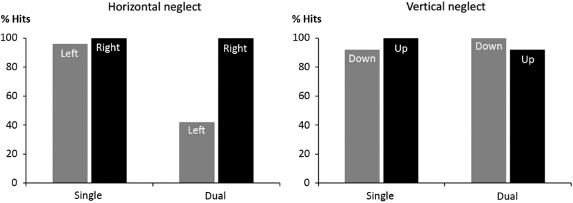 Increased Cognitive Load Reveals Unilateral Neglect and Altitudinal ...