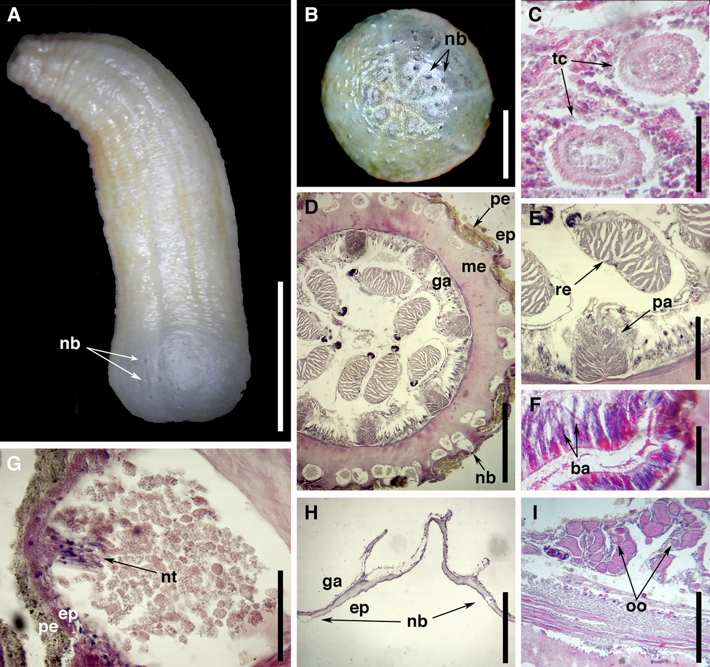 Diversity of Edwardsiidae sea anemones (Cnidaria: Anthozoa: Actiniaria ...