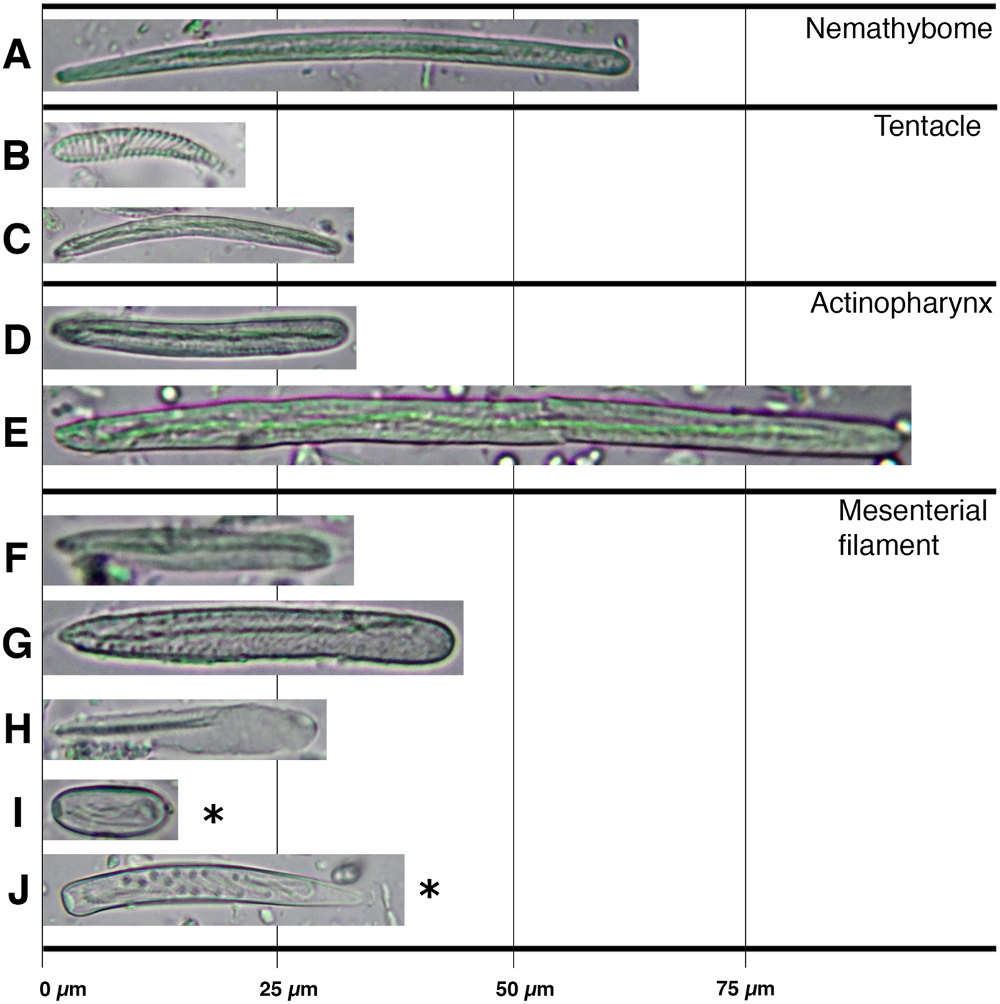 Diversity of Edwardsiidae sea anemones (Cnidaria: Anthozoa: Actiniaria ...