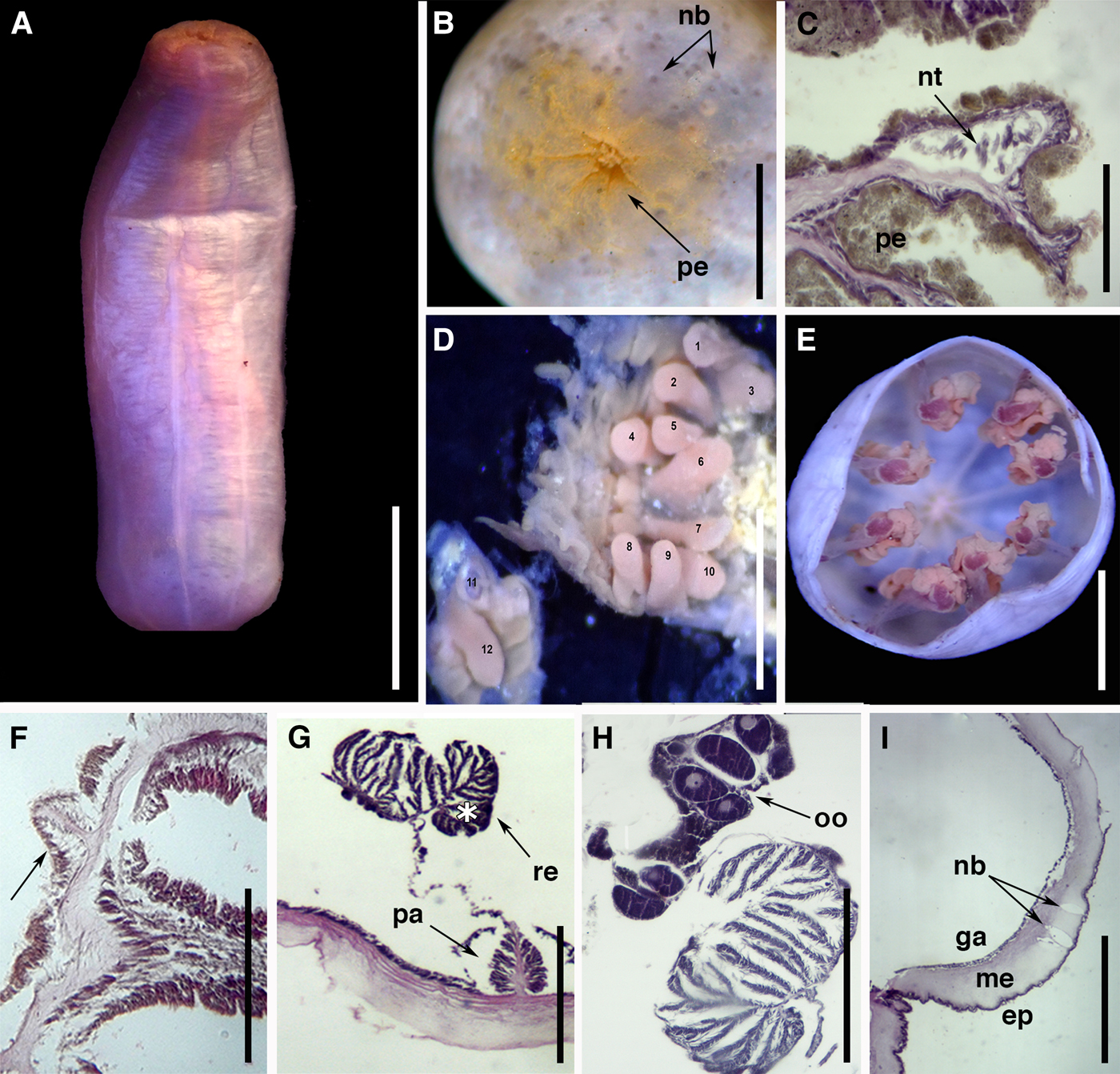 Diversity of Edwardsiidae sea anemones (Cnidaria: Anthozoa: Actiniaria ...