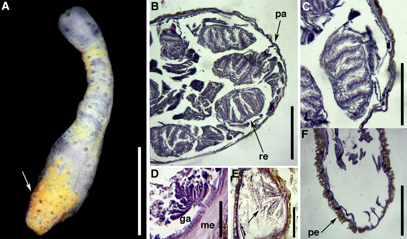 Diversity of Edwardsiidae sea anemones (Cnidaria: Anthozoa: Actiniaria ...