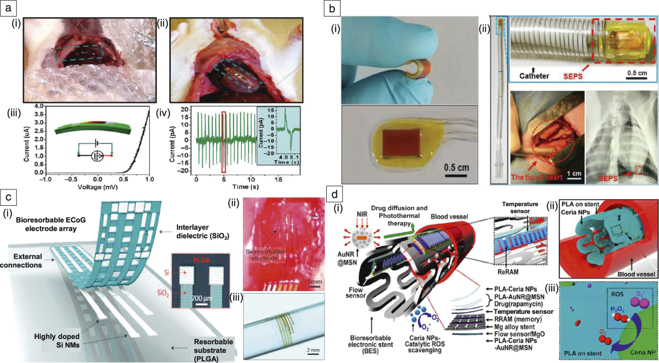 Nanomaterials-based flexible and stretchable bioelectronics | MRS ...