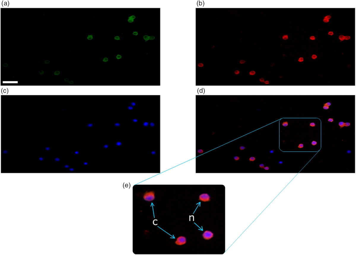DNA fragmentation index, pAKT and pERK1/2 in cumulus cells are related ...