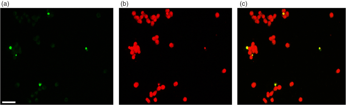 DNA fragmentation index, pAKT and pERK1/2 in cumulus cells are related ...