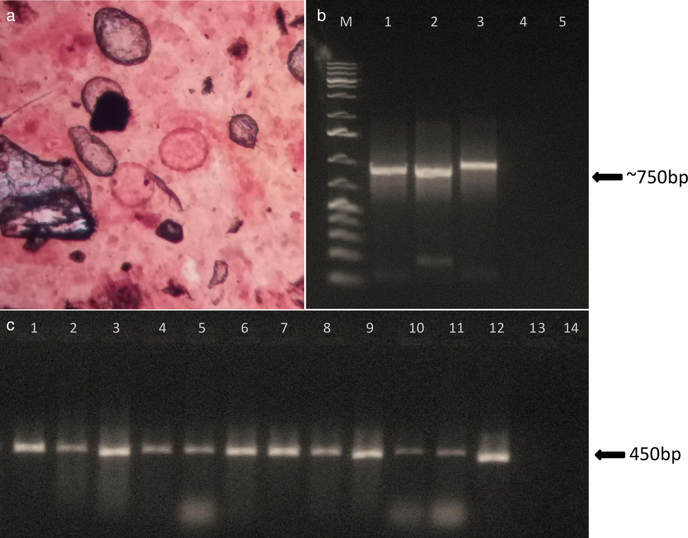 Kato–Katz thick smears as a DNA source of soil-transmitted helminths ...
