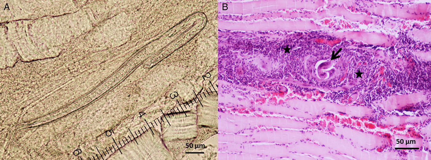 Human trichinellosis caused by Trichinella britovi in Greece, and ...