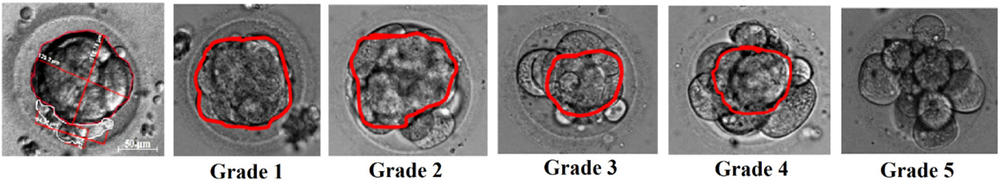 Cryopreservation of incomplete compacted morulae and preliminary biopsy ...