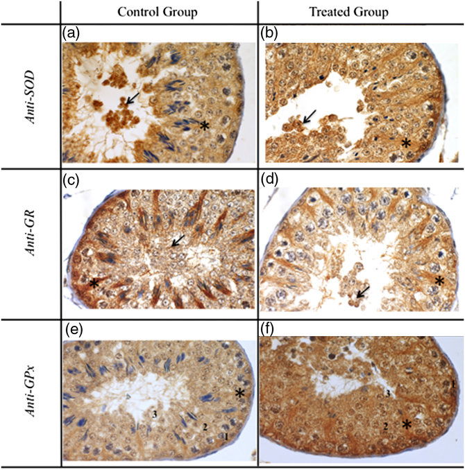Immunolocalization of antioxidant enzymes in testis of rams submitted ...