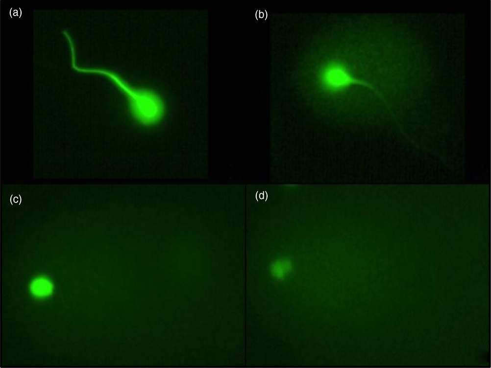 Sperm Dna Fragmentation Causes And Identification Zygote Cambridge
