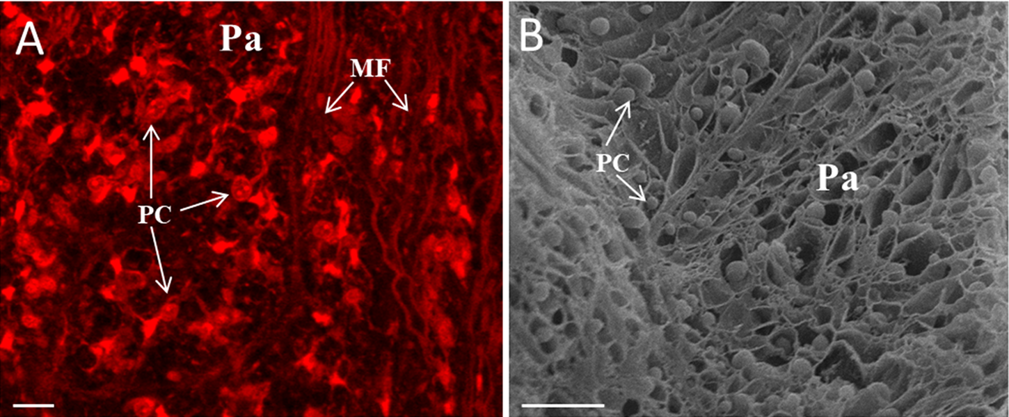 Eurytrema coelomaticum: updated morphology of adult worms using ...