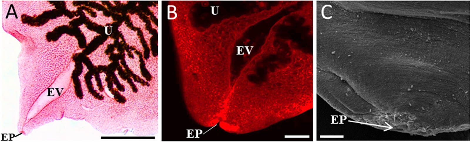 Eurytrema coelomaticum: updated morphology of adult worms using ...