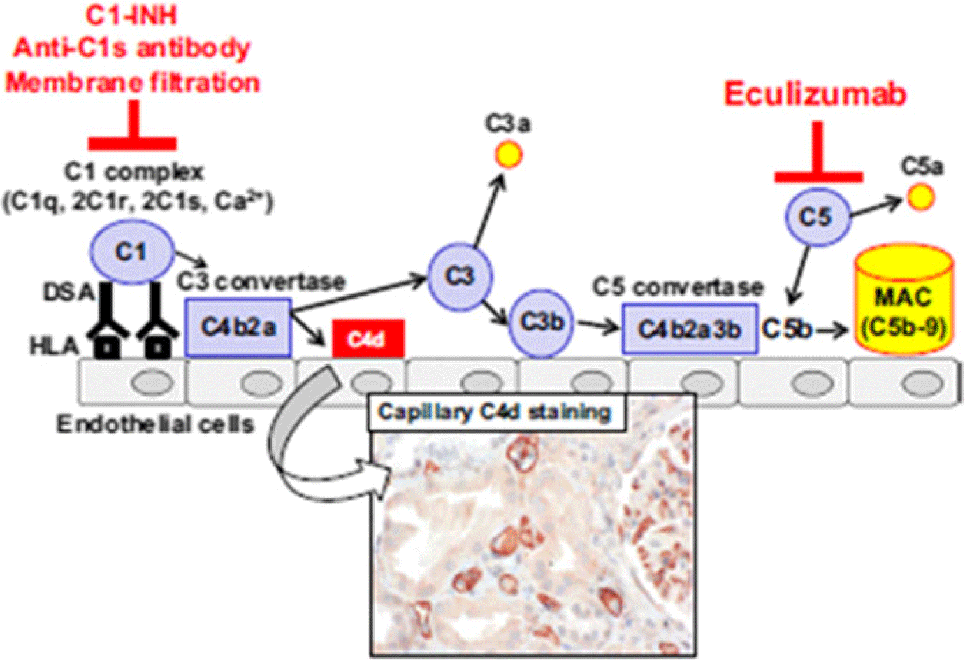 Use of the terminal complement inhibitor eculizumab in paediatric heart ...
