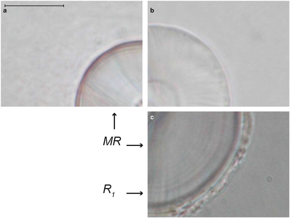 Morphology and Ontogeny of Statoliths in the Grooved Carpet Shell ...