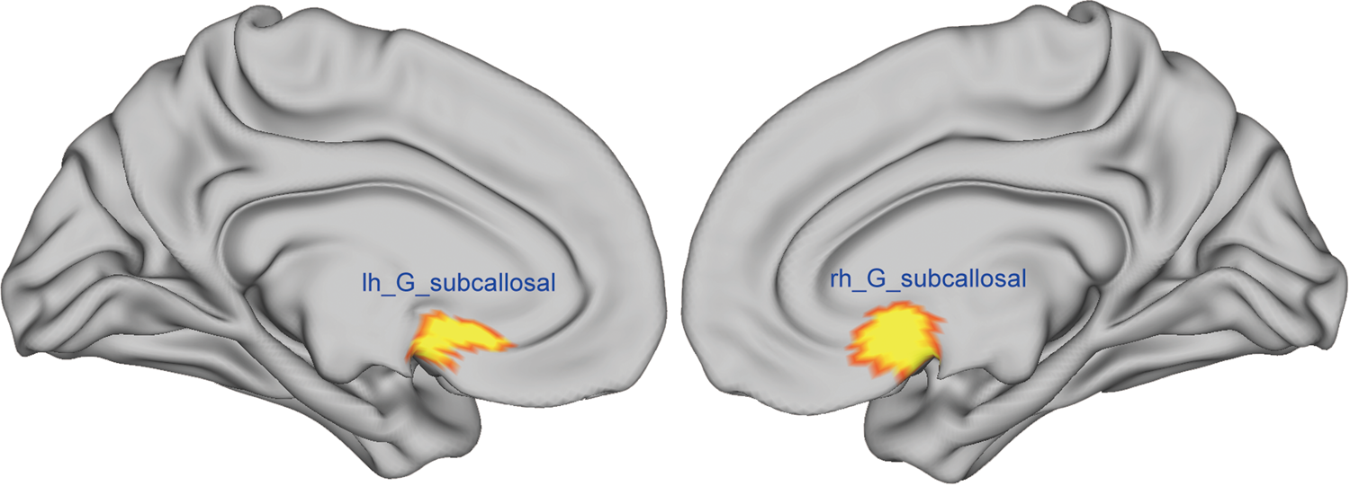 The reductions in the subcallosal region cortical volume and surface ...