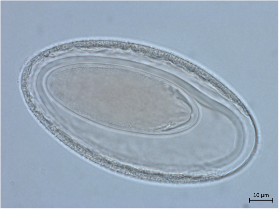Morphological and genetic description of Moniliformis necromysi sp. n ...