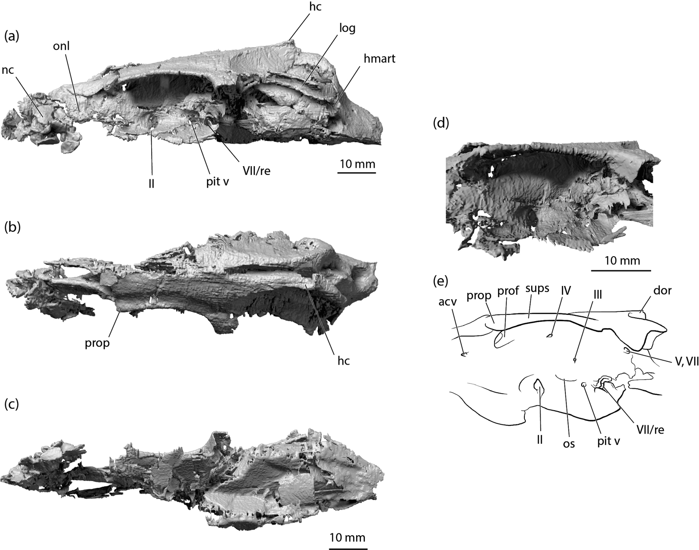 The neurocranium of the Lower Carboniferous shark Tristychius arcuatus ...