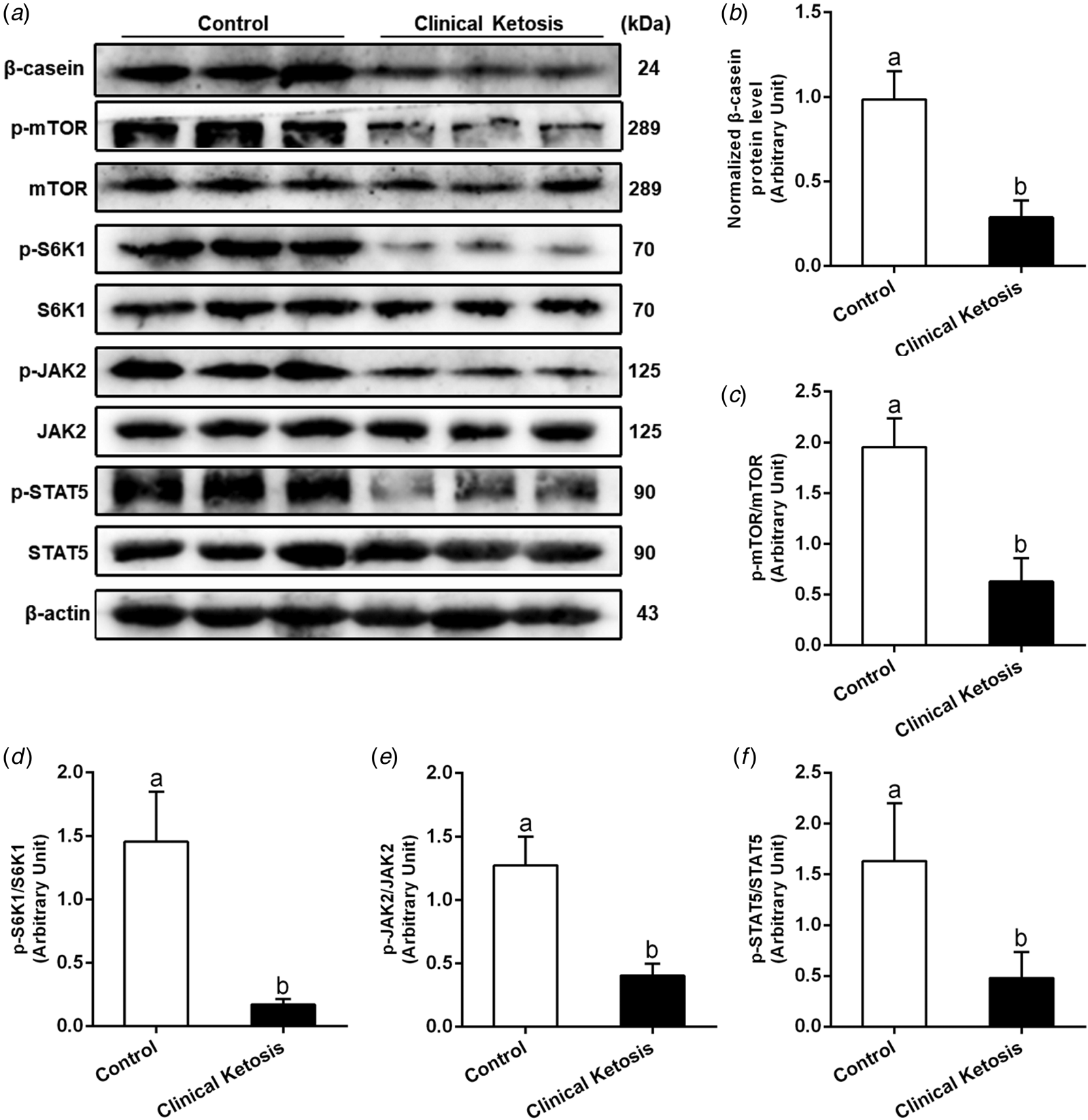 High levels of fatty acids inhibit β-casein synthesis through ...