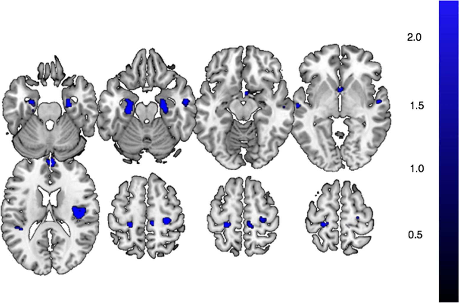 Investigating patterns of neural response associated with childhood ...
