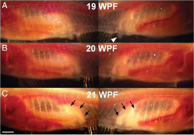 Puberty visualized: sexual maturation in the transparent Casper ...