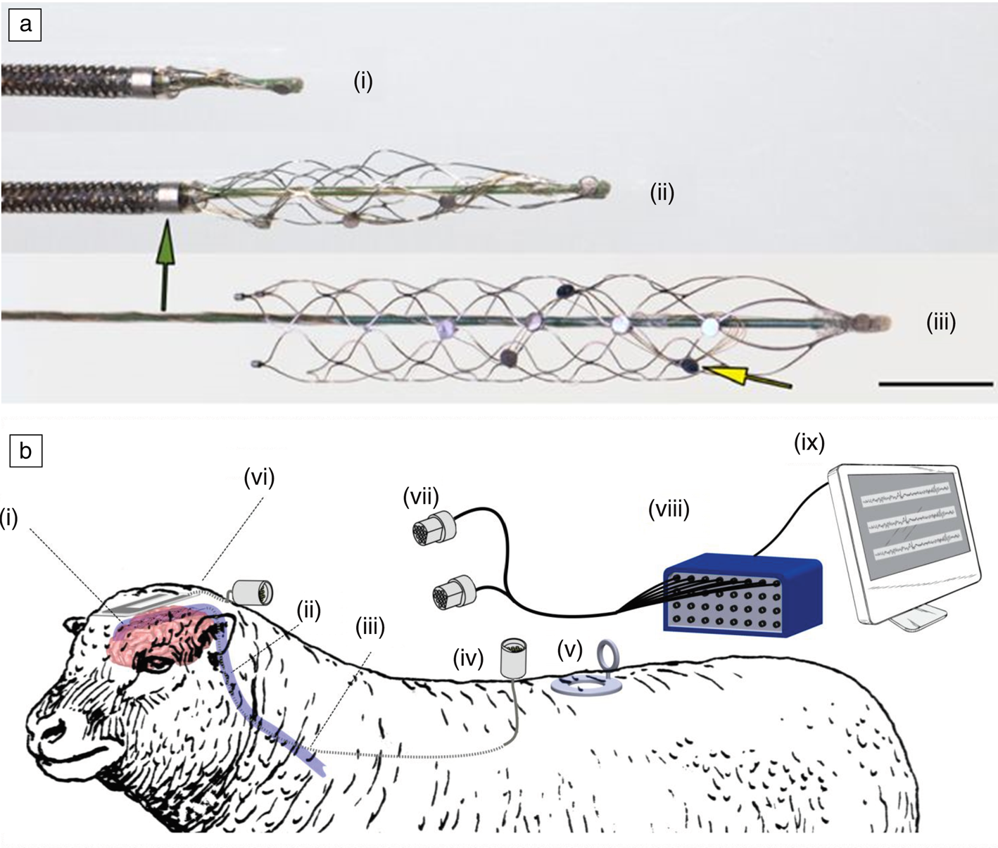 Recent advances in neural interfaces—Materials chemistry to clinical ...