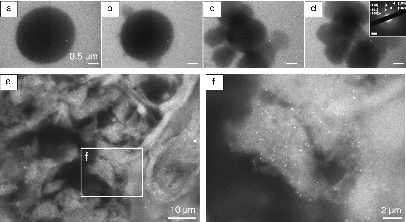Liquid phase electron microscopy of biological specimens | MRS Bulletin ...