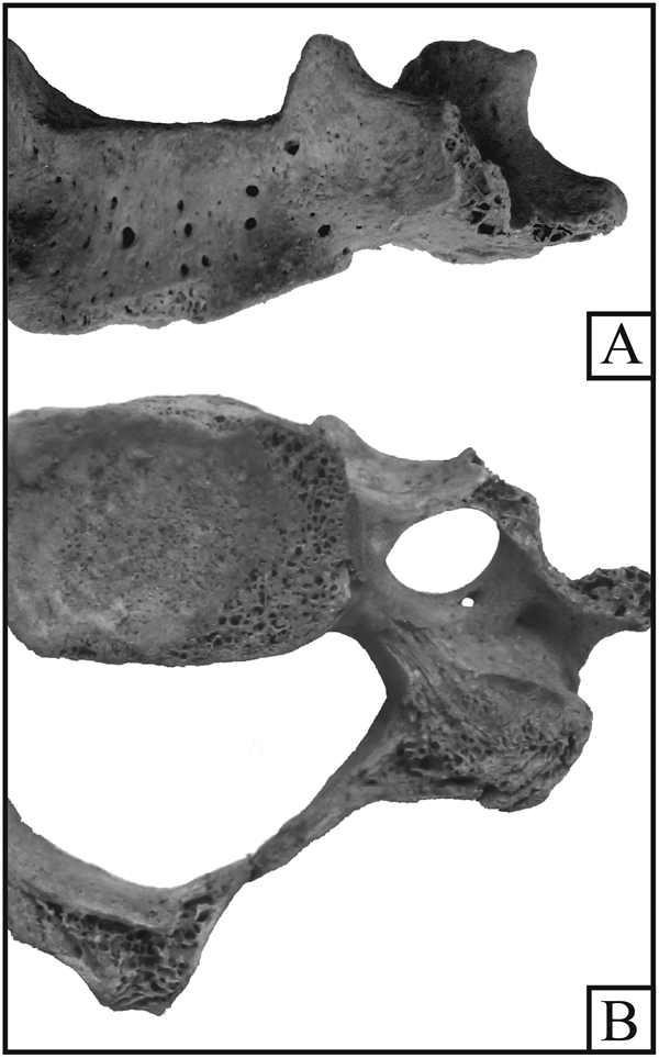 Medieval Masculinities and Violence: Weapon-Related Trauma in Skeletal ...