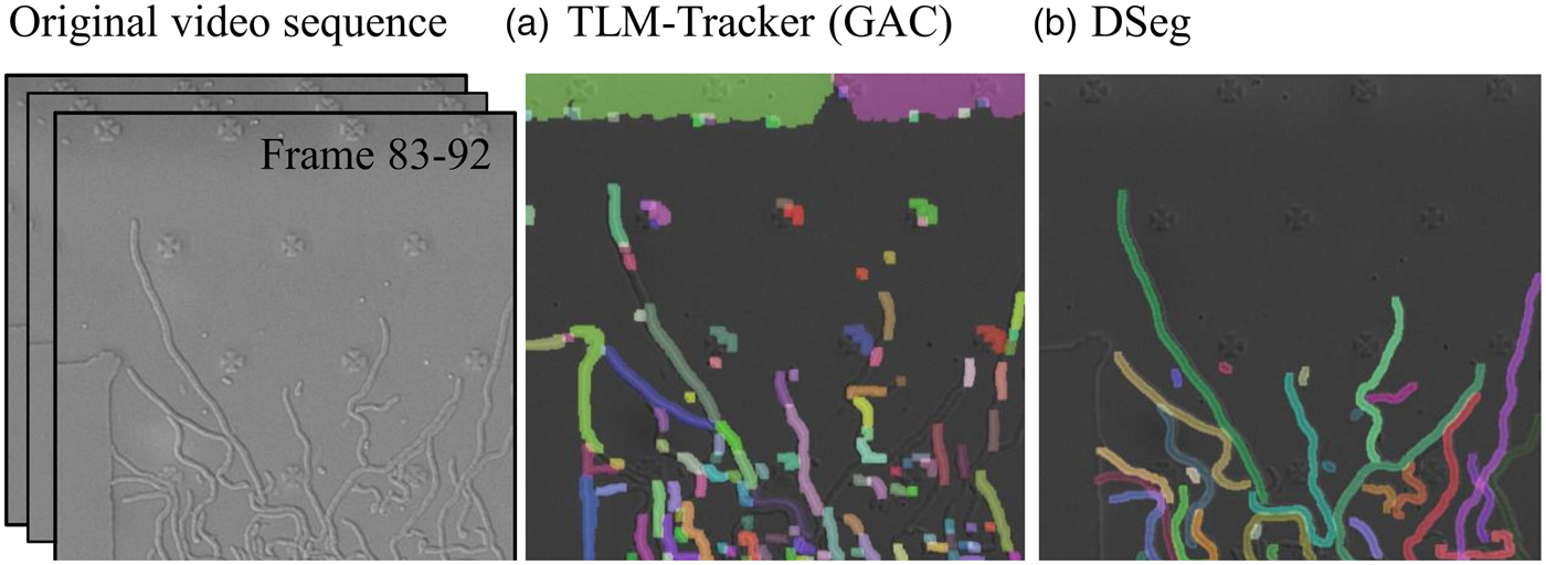 DSeg: A Dynamic Image Segmentation Program to Extract Backbone Patterns for Filamentous Bacteria ...