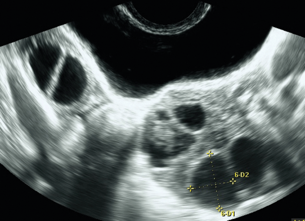 Introduction (Chapter 1) - Ultrasound in Assisted Reproduction and ...