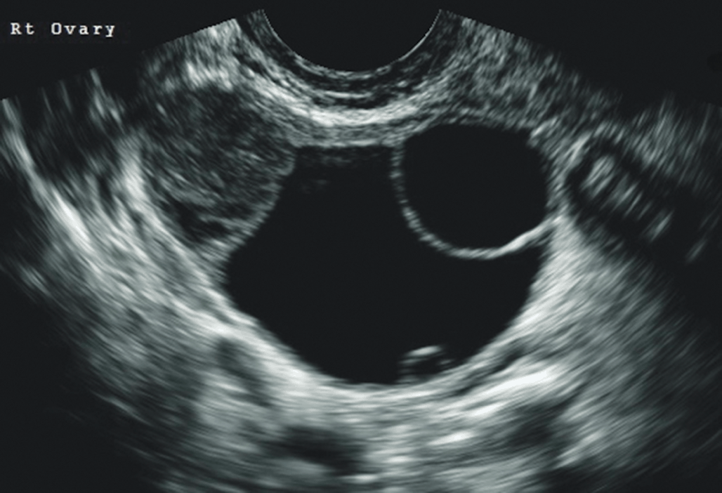 Physics and Instrumentation (Chapter 2) - Ultrasound in Assisted ...
