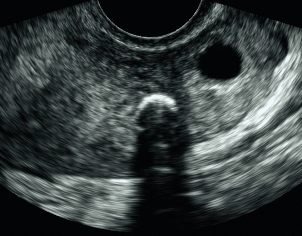 Physics and Instrumentation (Chapter 2) - Ultrasound in Assisted ...