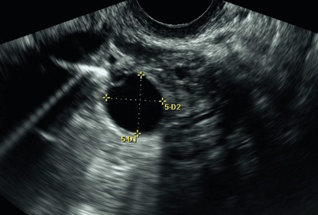 Physics and Instrumentation (Chapter 2) - Ultrasound in Assisted ...