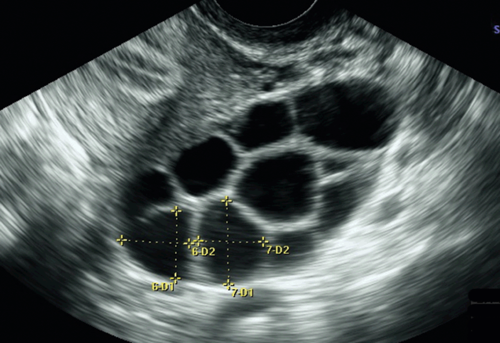 Physics and Instrumentation (Chapter 2) - Ultrasound in Assisted ...