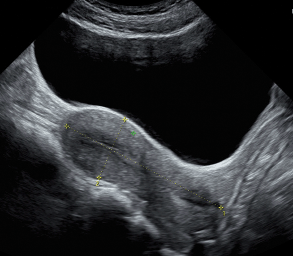 Physics and Instrumentation (Chapter 2) - Ultrasound in Assisted ...