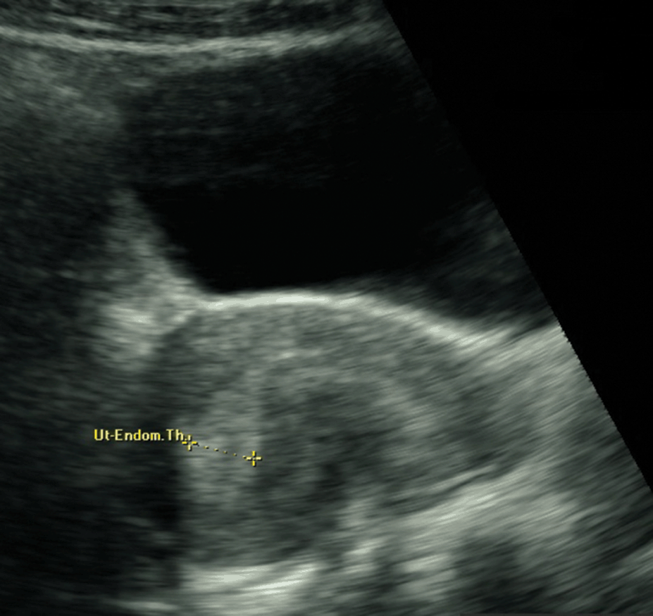 Physics and Instrumentation (Chapter 2) - Ultrasound in Assisted ...