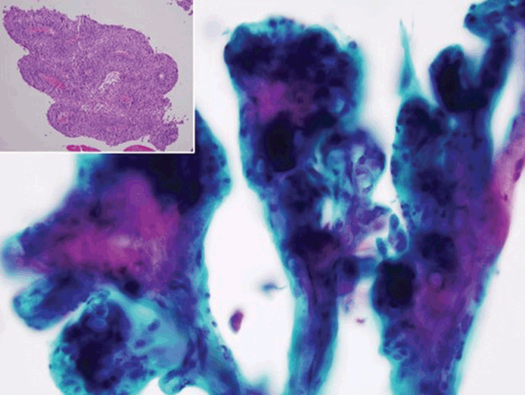 The Pap Smear (Chapter 1) - Differential Diagnosis in Cytopathology